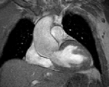 Mri GIF - Find on GIFER