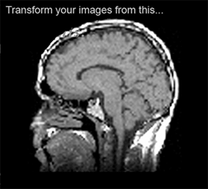 Mri GIF - Find on GIFER