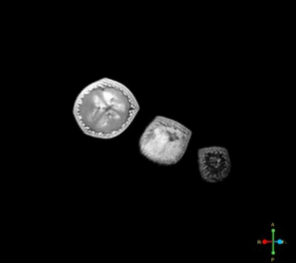 Scale mri GIF - Find on GIFER