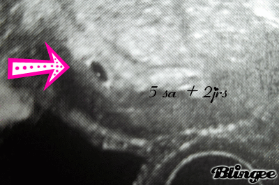 Echo GIF - Find on GIFER