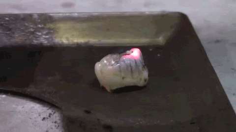 Tooth GIF - Find on GIFER