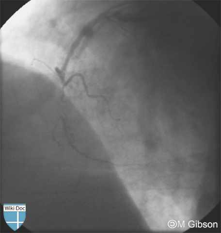 Collateral GIF - Find on GIFER