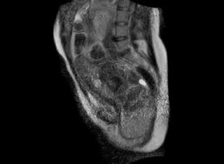 Mri GIF - Find on GIFER