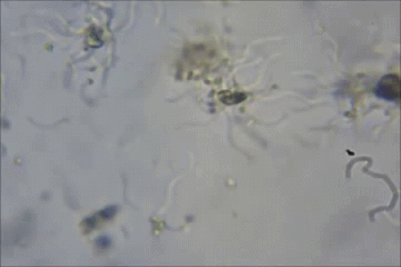 Bacteria GIF - Find on GIFER