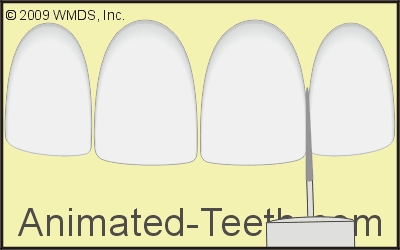 Teeth GIF - Find on GIFER