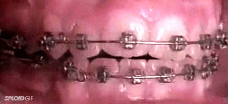 GIF teeth - animated GIF on GIFER