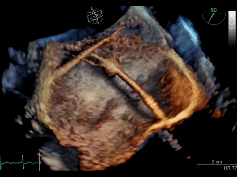 Now playing GIF - Find on GIFER