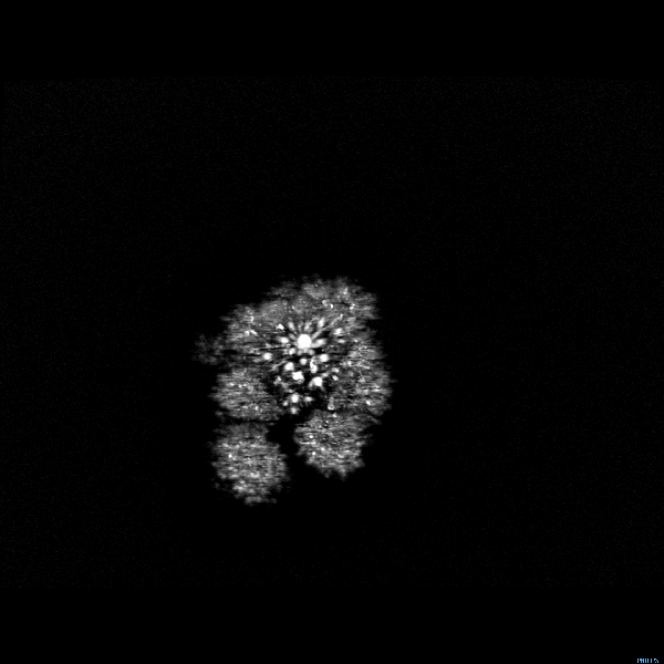 Mri scanner broccoli GIF on GIFER - by Cebor