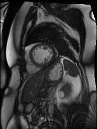 Deep learning GIF - Find on GIFER