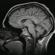 Brain GIF - Find on GIFER