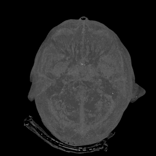 GIF bones - animated GIF on GIFER