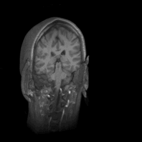 GIF brain - animated GIF on GIFER