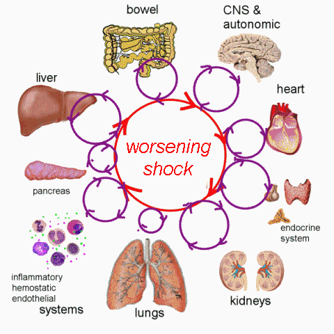 Shock GIF - Find on GIFER
