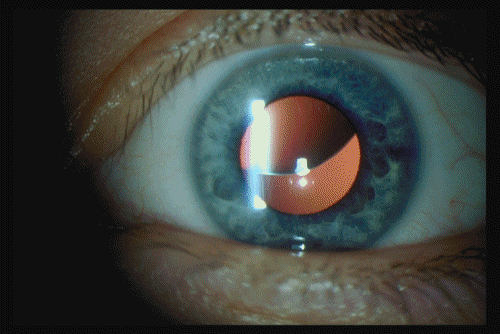 Ojo GIF - Encontrar en GIFER