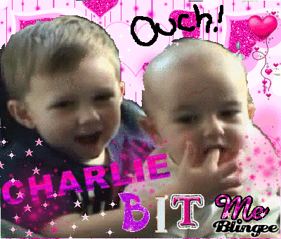 Ouch GIF - Find on GIFER