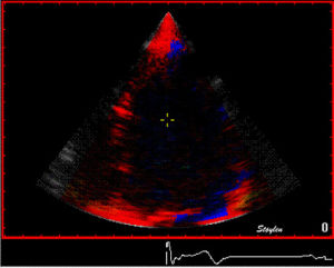 Ultrasound echocardiography line GIF - Find on GIFER