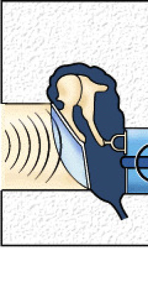 Ear GIF on GIFER - by Gralen