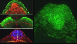 GIF brain neuron neuroscience - animated GIF on GIFER