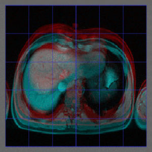 GIF computer vision - animated GIF on GIFER