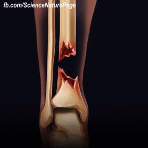 New educational bone GIF - Find on GIFER