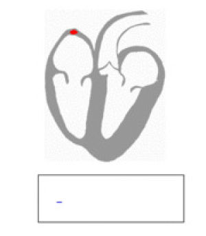 GIF the normal heart - animated GIF on GIFER