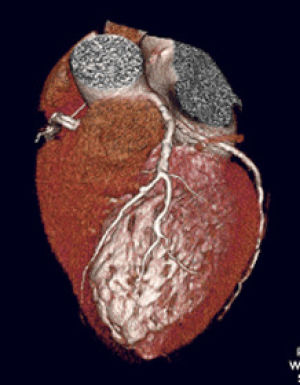 GIF the normal heart - animated GIF on GIFER
