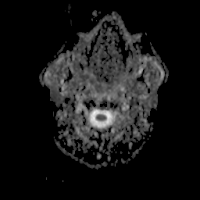 Resonance GIFs - Get the best gif on GIFER