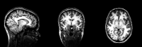 Mri GIFs - Get the best gif on GIFER