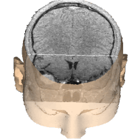 Brain GIFs - Get the best gif on GIFER