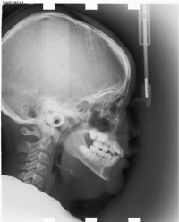 X ray inside information GIF - Conseguir o melhor gif em GIFER