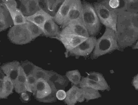 Cancer GIFs - Get the best gif on GIFER