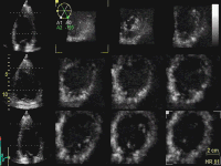 Ultrasound GIFs - Get the best gif on GIFER