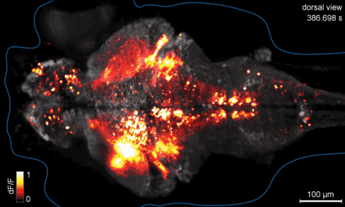 Neurology GIFs - Obtenez le meilleur gif sur GIFER