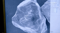 Fluorescence microscopy GIFs - Get the best gif on GIFER