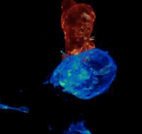 Cancer GIFs - Get the best gif on GIFER