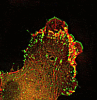 Cancer GIFs - Get the best gif on GIFER