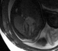 Uterus GIFs - Get the best gif on GIFER