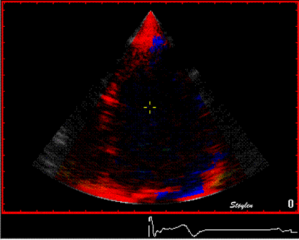 Doppler GIFs - Get the best gif on GIFER