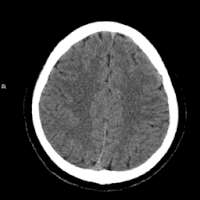 Ct GIFs - Get the best gif on GIFER