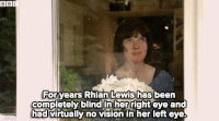 Blindness GIFs - Get the best gif on GIFER
