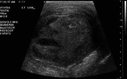 Ultrasonido GIF - Conseguir el mejor gif en GIFER