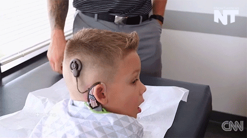 Auditory brainstem implant GIF - Conseguir o melhor gif em GIFER