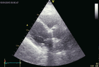 Ultrasound GIFs - Get the best gif on GIFER