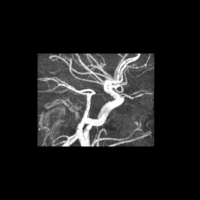 Mri GIFs - Get the best gif on GIFER