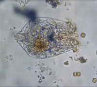Rotifers GIFs - Get the best gif on GIFER