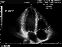 Ultrasound GIFs - Get the best gif on GIFER