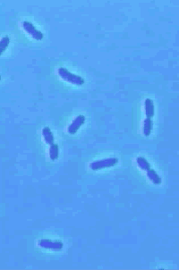 Tuberculosis GIFs - Get the best gif on GIFER