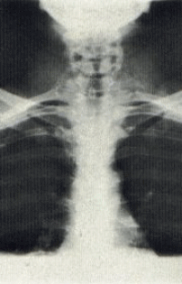 Рентген GIFs - Get the best gif on GIFER