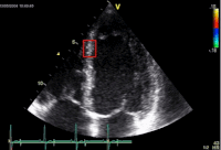 Echocardiography GIFs - Get the best gif on GIFER