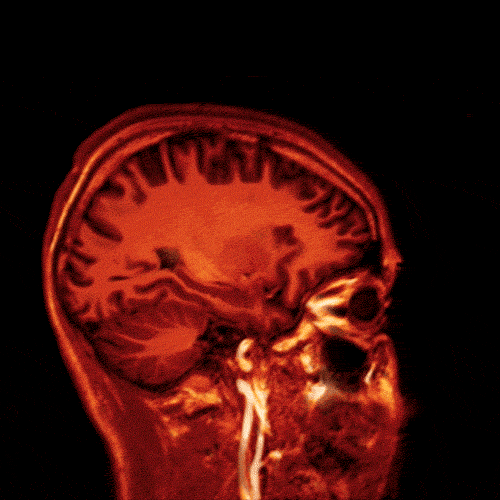 Imaging GIF - Conseguir o melhor gif em GIFER